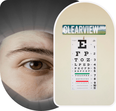 Top-Rated LASIK Surgery in San Diego | Clearview Eye