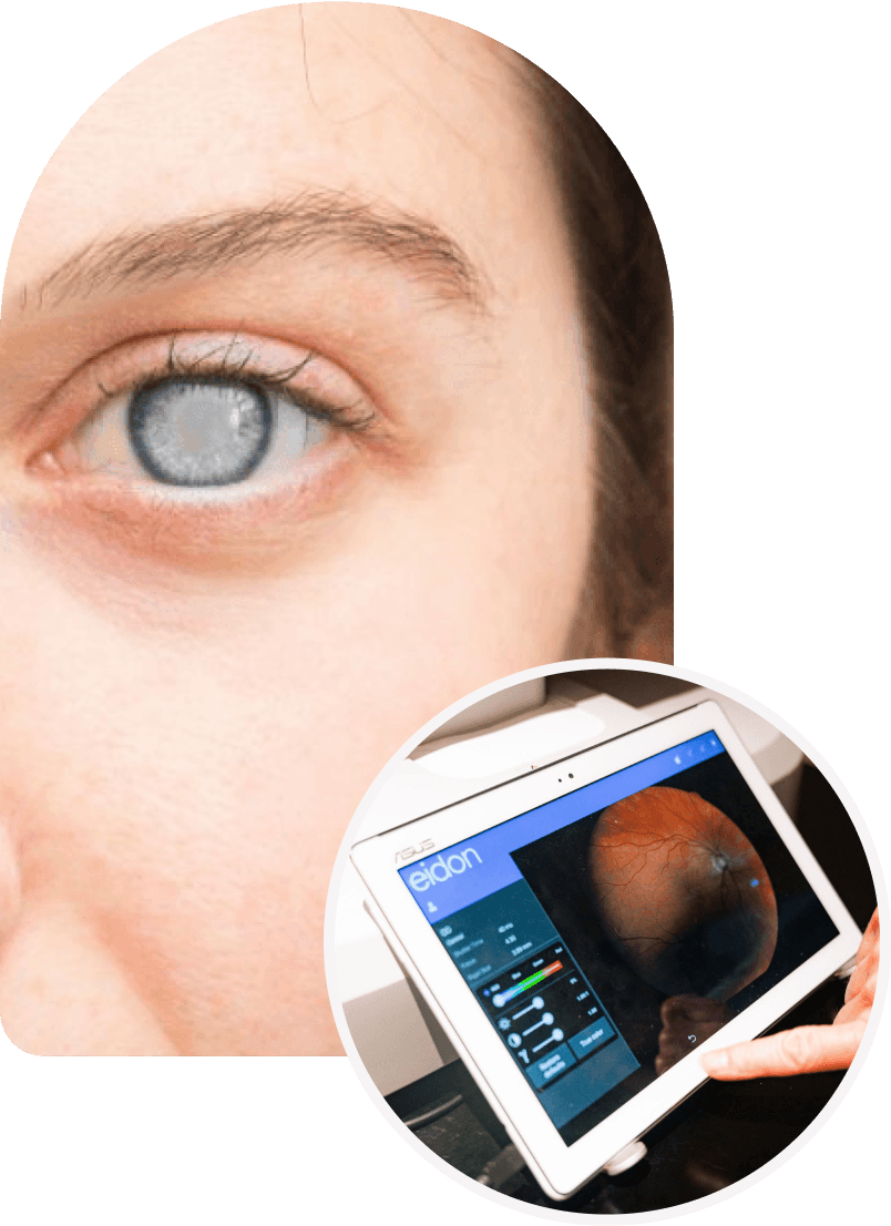 Clearview Eyes: LASIK Eye Surgery San Diego, #1 LASIK Surgeons